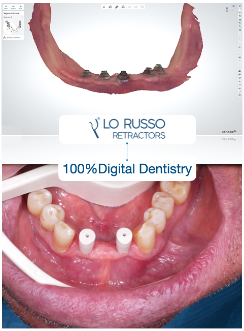 LO RUSSO RETRACTORS | Home